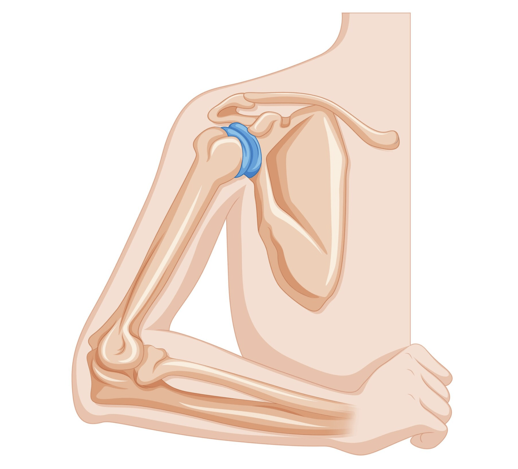 Todo Sobre La Bursitis De Hombro. Causas Y Tratamientos – ZHERSS